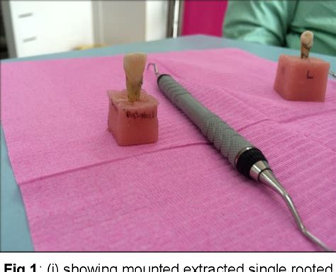 Figure 1 From Evaluation Of Root Debridement Skill In Periodontology Module Semantic Scholar