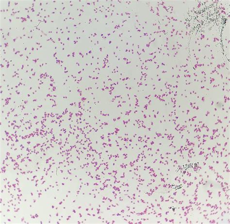 Dr Microbe