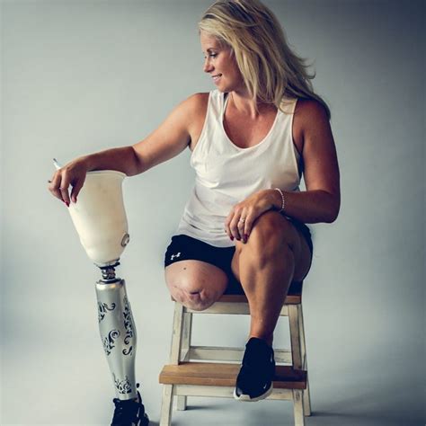 Amputee Lianne Forrest Shares Her Story Of Body Confidence