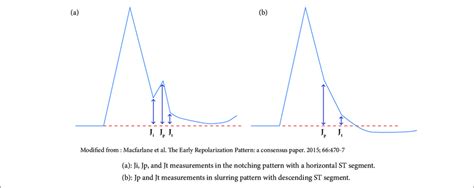 Notching Measurements In The Descending Pattern And Slurring