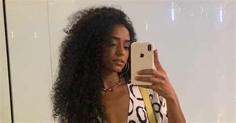 Isis Freitas Estava Internada Por Causa De Tuberculose Purebreak