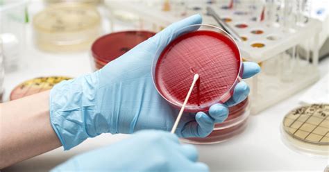 Urine Culture And Sensitivity Test Purpose Procedure And Results