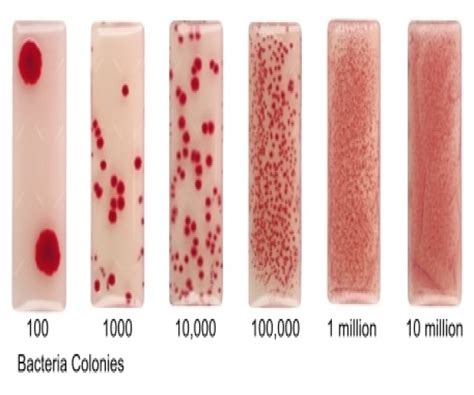 Bacterial Testing Kits Life Technologist