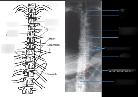 Ap T Spine Diagram Quizlet