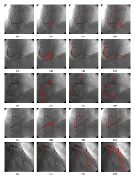 seed point extraction results of five groups of data sets the first to