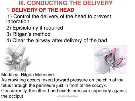 Management Ofvnormal Labour