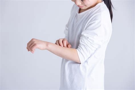 鍼灸でみる【アトピー性皮膚炎】〜西洋医学編〜 山王はりきゅうマッサージ処 りゅうしん堂 りゅうしん堂ブログ