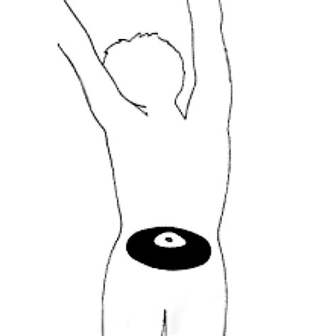 Lupron Only Trigger Patient Instructions Uh Fertility Center University Hospitals