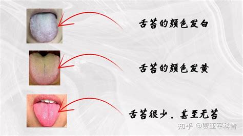 如何从舌苔上看出病情的进程？薄厚苔、润燥苔、腻腐苔如何调理？ 知乎