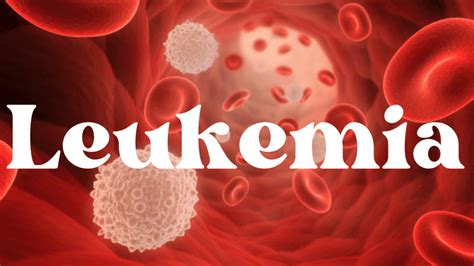 Understanding Leukemia 7 Critical Facts To Know