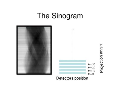 Ppt Computed Tomography Powerpoint Presentation Free Download Id