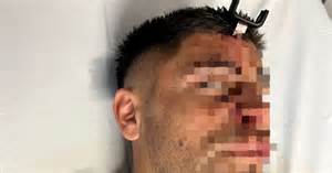 Conmoción En El Fútbol En Medio De Una Pelea Le Clavaron Una Llave En