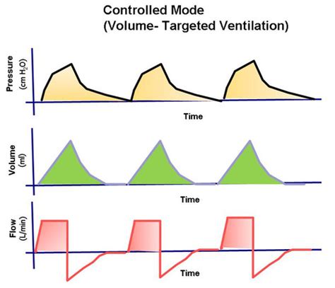 Selecting The Ventilator And Mode Flashcards Quizlet