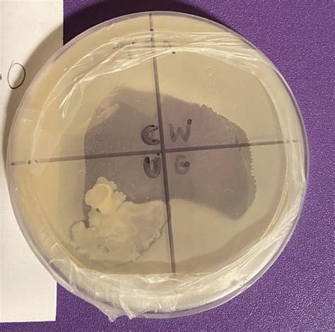 Identifying The Morphologies Of Microbe Colonies Rmicrobiology