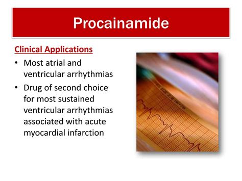 Ppt Anti Arrhythmic Drugs Powerpoint Presentation Free Download Id2237629