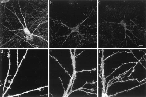 Estradiol Effects On Miniature Epsc S In Cultured Neurons A Download Scientific Diagram