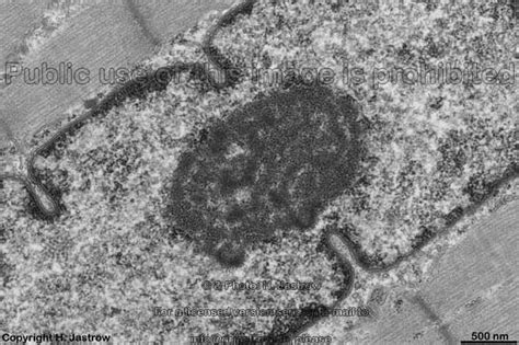 Nucleolus Drjastrows Electron Microscopic Atlas
