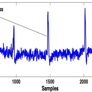 The Observed Raw EEG Data With EB For The Subject S11 Download Scientific Diagram