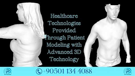 The Future Of Pectus Deformities 3d Printing Technology And Innovative