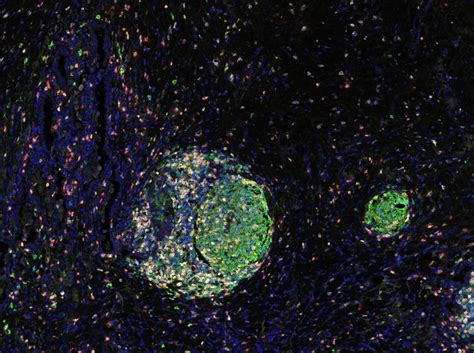 Image Of The Month A Closer Look At Tertiary Lymphoid Structures