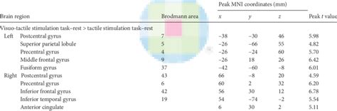 Significant Brain Activation Area Between Visuo Tactile And Tactile Download Table