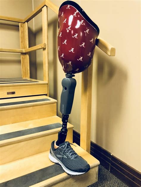 Rheo Knee With Variflex And Badass Socket Rprosthetics