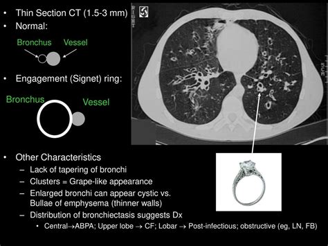 Common And Uncommon Causes Of Chronic Cough Ppt Download