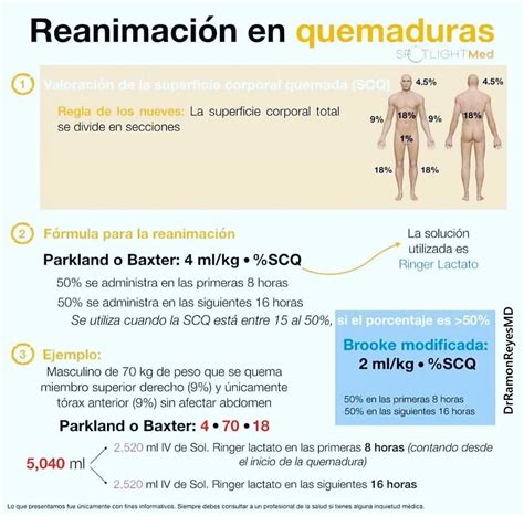 Ems Solutions International Formula De Parkland Vs Actualizacion De