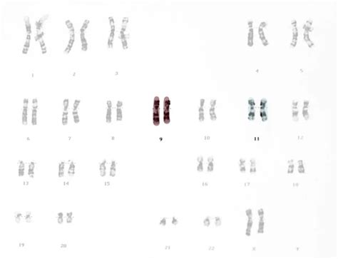 Chromosomal Analysis Karyotype And Microarray I Modern Reproduction
