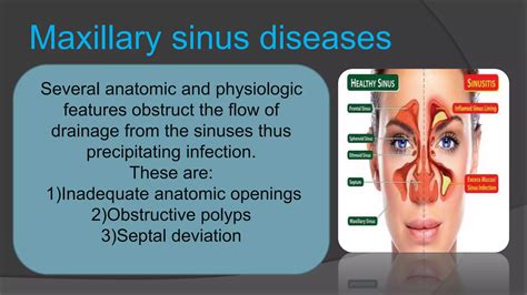 Maxillary Sinus Diseases Pptx