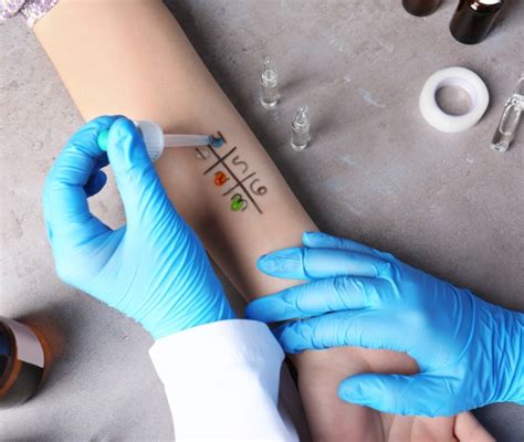 Prick Test Allergie Skin Prick Test E Prick By Prick Test