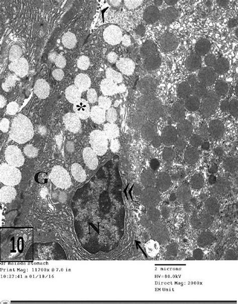 An Electron Micrograph Of Mucous Neck Cell Of The Control Group Download Scientific Diagram