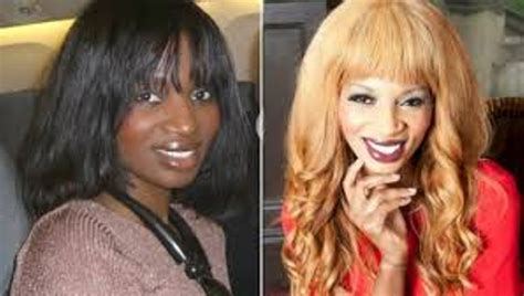 Negative Effects Of Skin Bleaching