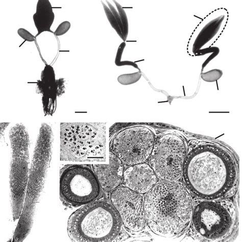 Anatomy And Histology Of The Reproductive System Of Male Trypoxylon