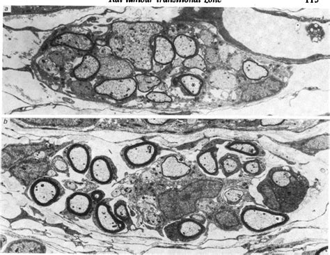 Figure 2 From The Lumbar Ventral Root Spinal Cord Transitional Zone In