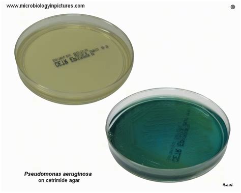 Cetrimide Agar Alchetron The Free Social Encyclopedia