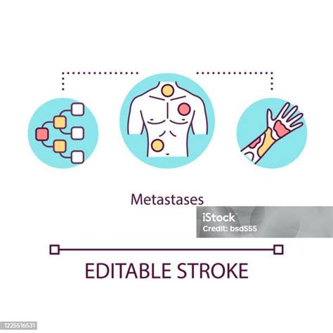 전이 개념 아이콘입니다 종양학 아이디어 얇은 라인 그림입니다 악성 신 생물 종양 확산 암세포 보급 벡터 절연 윤곽선 Rgb 색상 드로잉 편집 가능한 스트로크 암에 대한 스톡