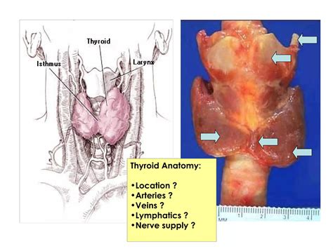 Pathology Of Thyroid And Endocrine Disorders Ppt