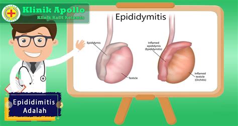 Epididimitis Adalah Inilah Penyebab Dan Gejalanya Klinik Apollo Jakarta