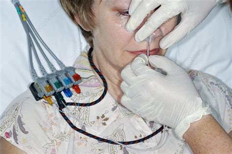 Oesophageal Manometry And Ph Testing Stock Image C0105172