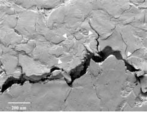 Higher Magnification Of Subchondral Bone Microfracture With Collapsed