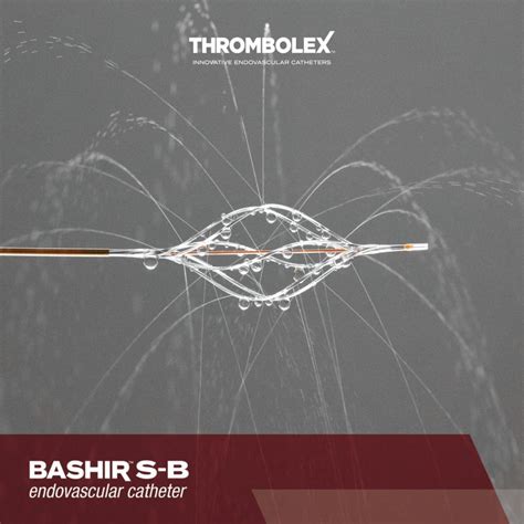 Thrombolex Inc On Linkedin Thrombolex