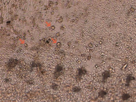 努力不一定會成功 但成功一定需要努力 Cpe照片分享 補上respiratory Syncytial Virus Rsv 呼吸道融合病毒 在hep 2細胞的照片