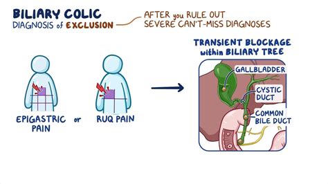 Approach To Biliary Colic Video And Meaning Osmosis