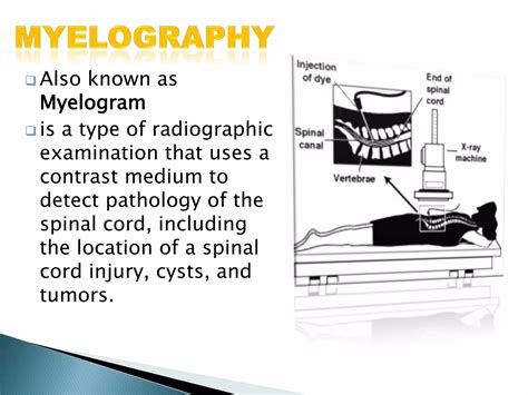 Myelography Pptx