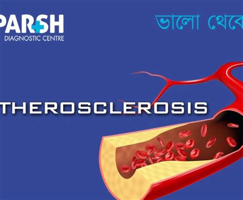 H Pylori Understanding The Hidden Stomach Invader Sparsh Diagnostic