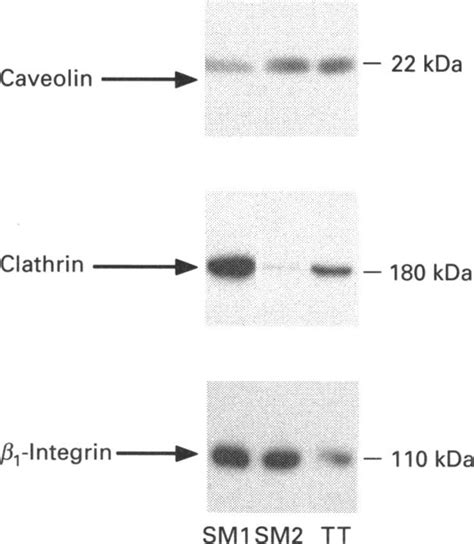 Distribution Of Caveolin And Clathrin Heavy Chain In Sarcolemmal Download Scientific Diagram