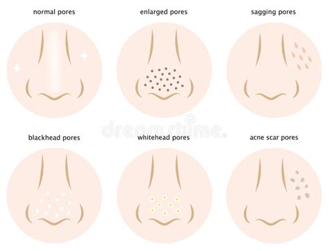Kinds Of Skin Pores Stock Vector Illustration Of Face 76633224
