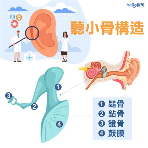 懷孕後聽力變差？一次搞懂耳硬化症的原因、症狀及治療