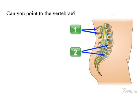Lumbar Laminectomy And Possible Disk Excision Minimally Invasive